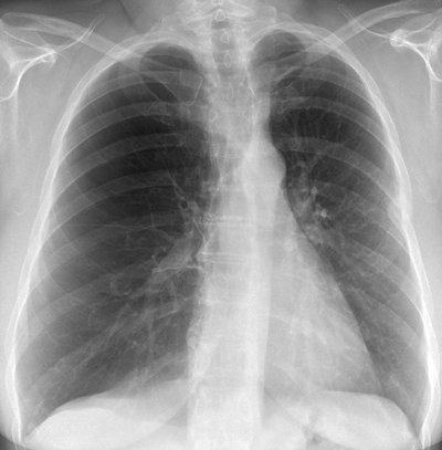 Ovid: Chest Radiology: The Essentials