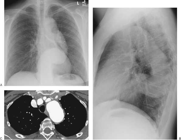 Ovid: Chest Radiology: The Essentials